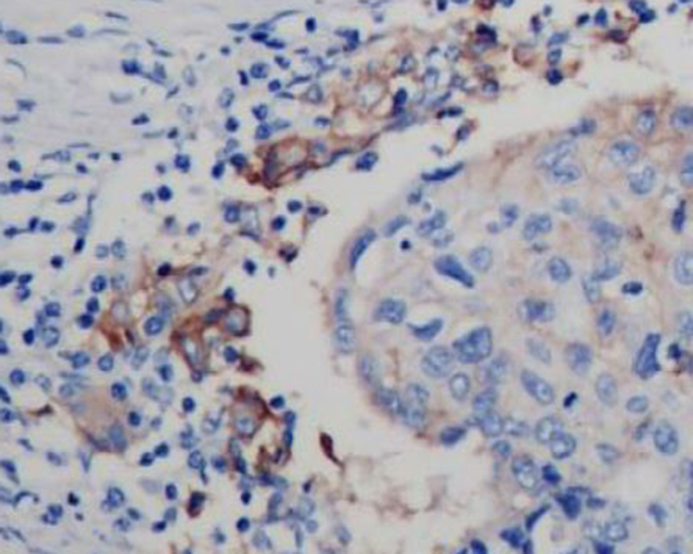 New PD-1 ELISA Kit, excellent for preclinical studies or ...
