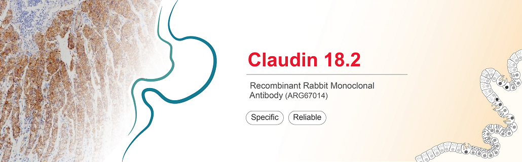Fight gastric cancer by targeting Claudin 18.2 - News - Company - arigo ...