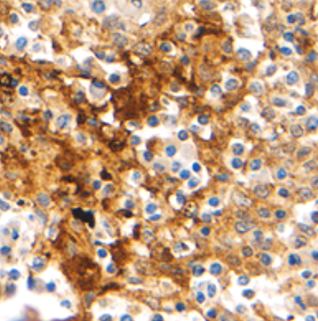 anti-PACAP Receptor antibody (ARG56232) - arigo Biolaboratories