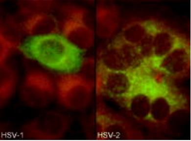 anti-HSV gD antibody [2C10] (ARG22392) - arigo Biolaboratories
