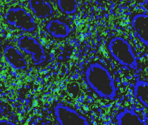 Astrocyte Maturation Muller Cell Marker Antibody Duo (GFAP, Vimentin ...