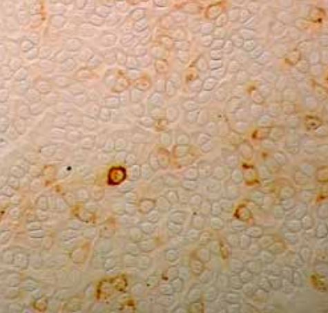 anti-IBDV Gumboro disease virus VP3 antibody [IBDV9] (ARG11065) - arigo ...