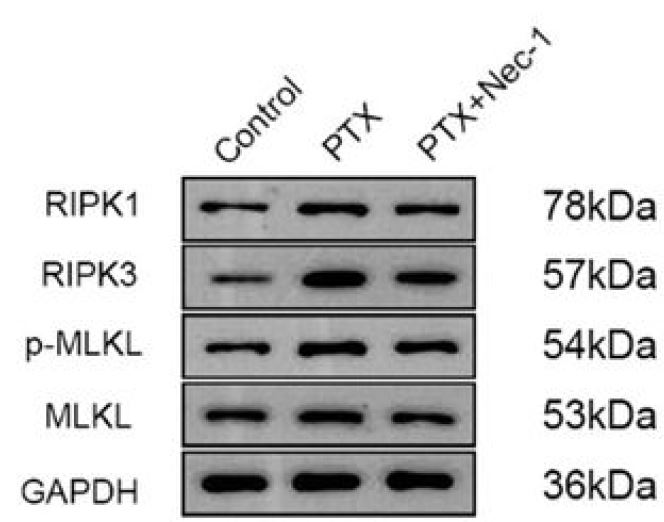 anti-RIPK3 RIP3 phospho (Ser232) antibody (ARG41235) - arigo ...