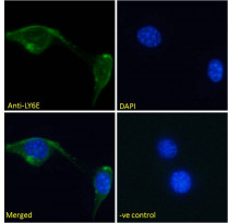 anti-LY6E antibody (ARG65280) - arigo Biolaboratories