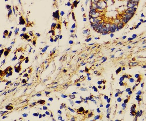 anti-TREM2 antibody (ARG42050) - arigo Biolaboratories