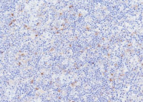 anti-TIM3 antibody [SQab22265] (ARG66922) - arigo Biolaboratories