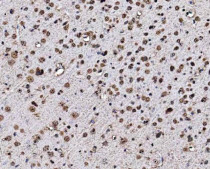 anti-Matrin 3 antibody (ARG44225) - arigo Biolaboratories