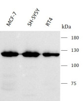 anti-Matrin 3 antibody (ARG44225) - arigo Biolaboratories