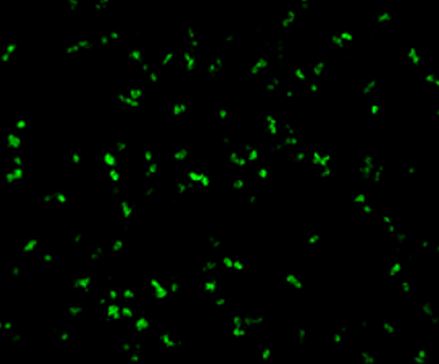 anti-Infectious Bursal Disease Virus IBDV Variant VP2 Protein antibody ...