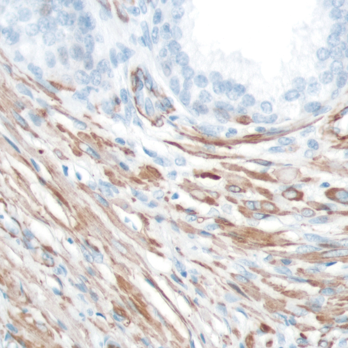 anti-alpha smooth muscle Actin antibody [SP171] (ARG52489) - arigo ...