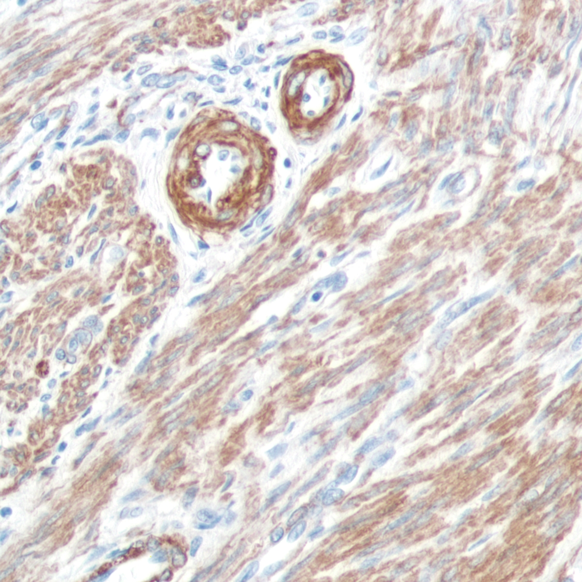 anti-alpha smooth muscle Actin antibody [SP171] (ARG52489) - arigo ...