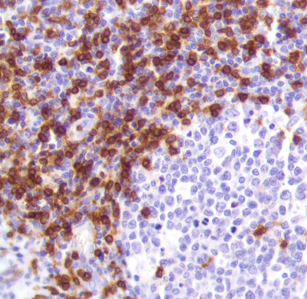General Lymphocyte Marker Antibody Panel (CD3, CD14, CD16, CD19, CD56 ...