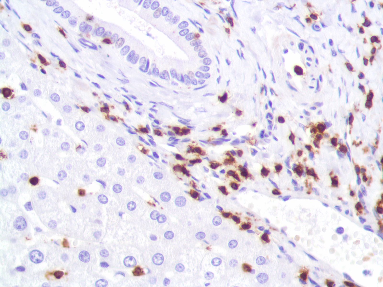 Lymphocyte Marker Antibody Duo (CD3, CD19)(IHCICC) (ARG30127) - arigo ...