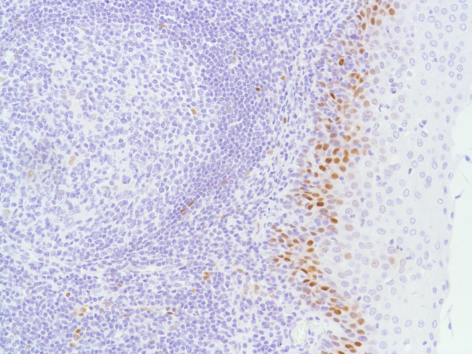 anti-Cyclin D1 antibody [SP4] (ARG52923) - arigo Biolaboratories