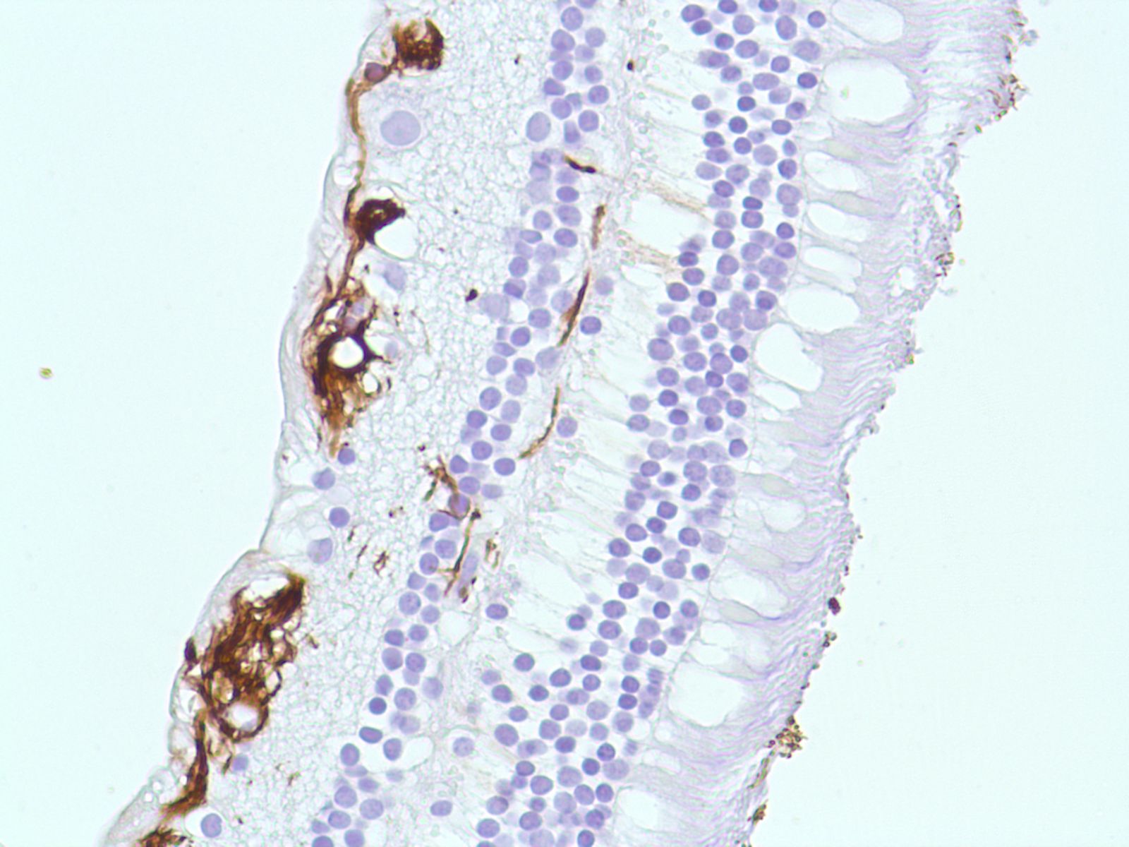 Brain Injury IHC Marker Antibody Duo (GFAP, MMP9) (ARG30292) - arigo ...