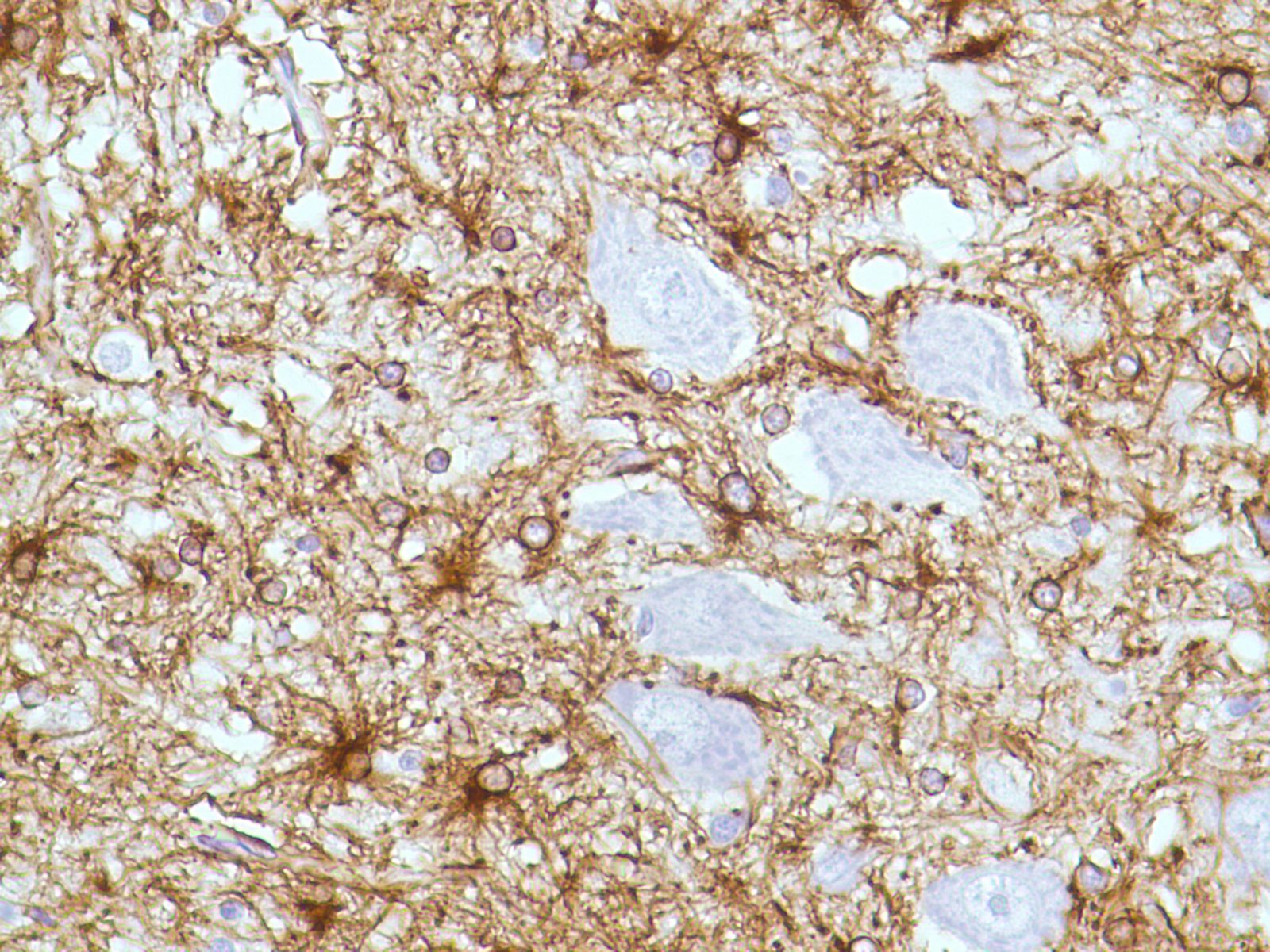 Brain Injury IHC Marker Antibody Duo (GFAP, MMP9) (ARG30292) - arigo ...