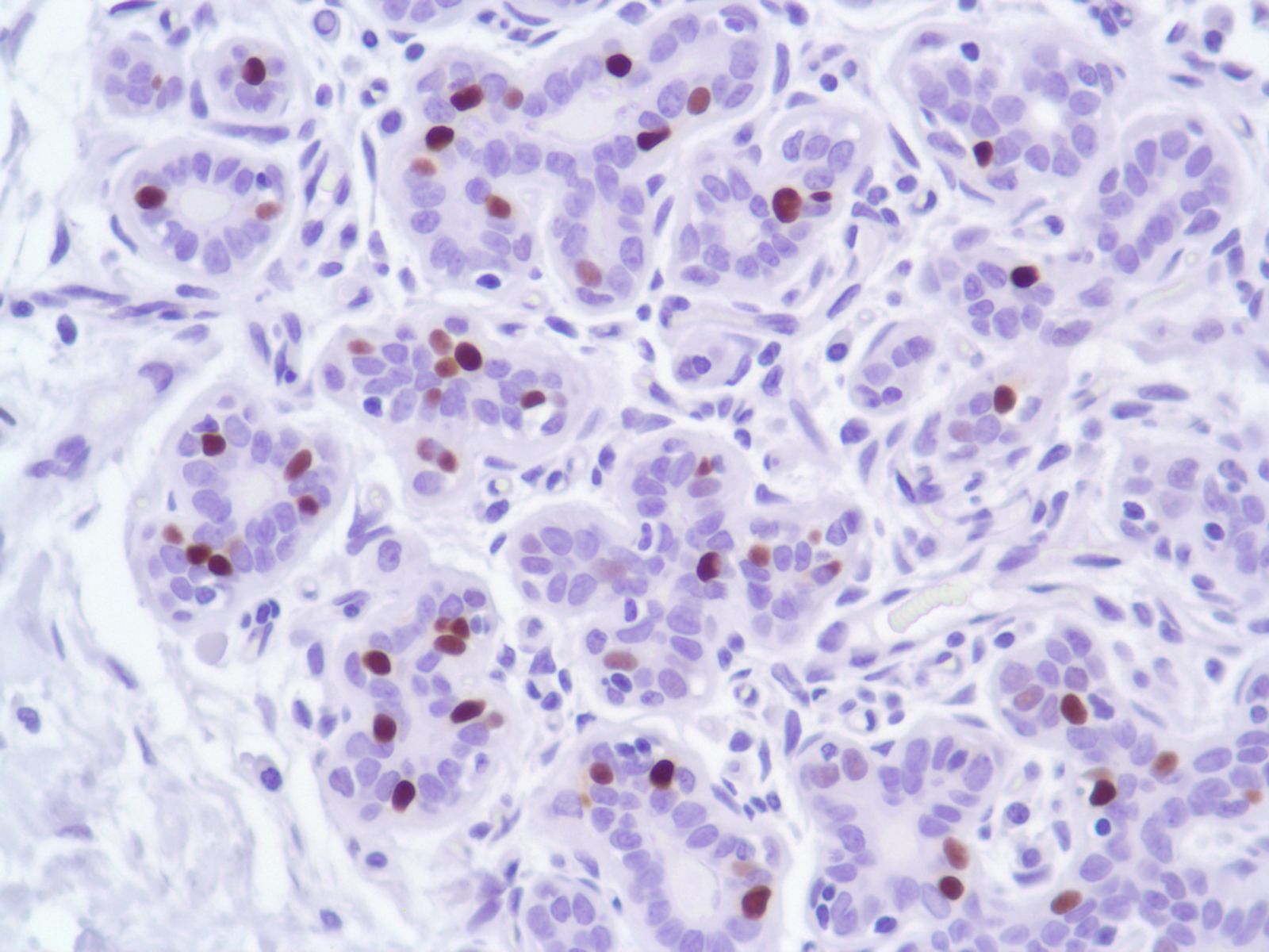 anti-Progesterone Receptor antibody [SP42] (ARG53495) - arigo ...