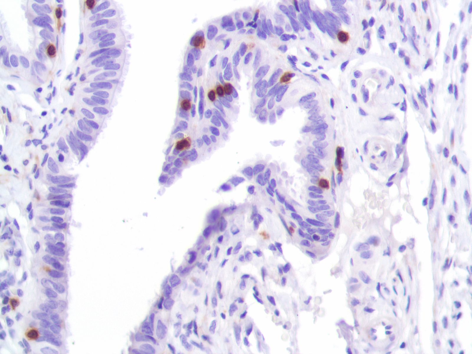 Lymphocyte Marker Antibody Duo (CD3, CD19)(IHCICC) (ARG30127) - arigo ...