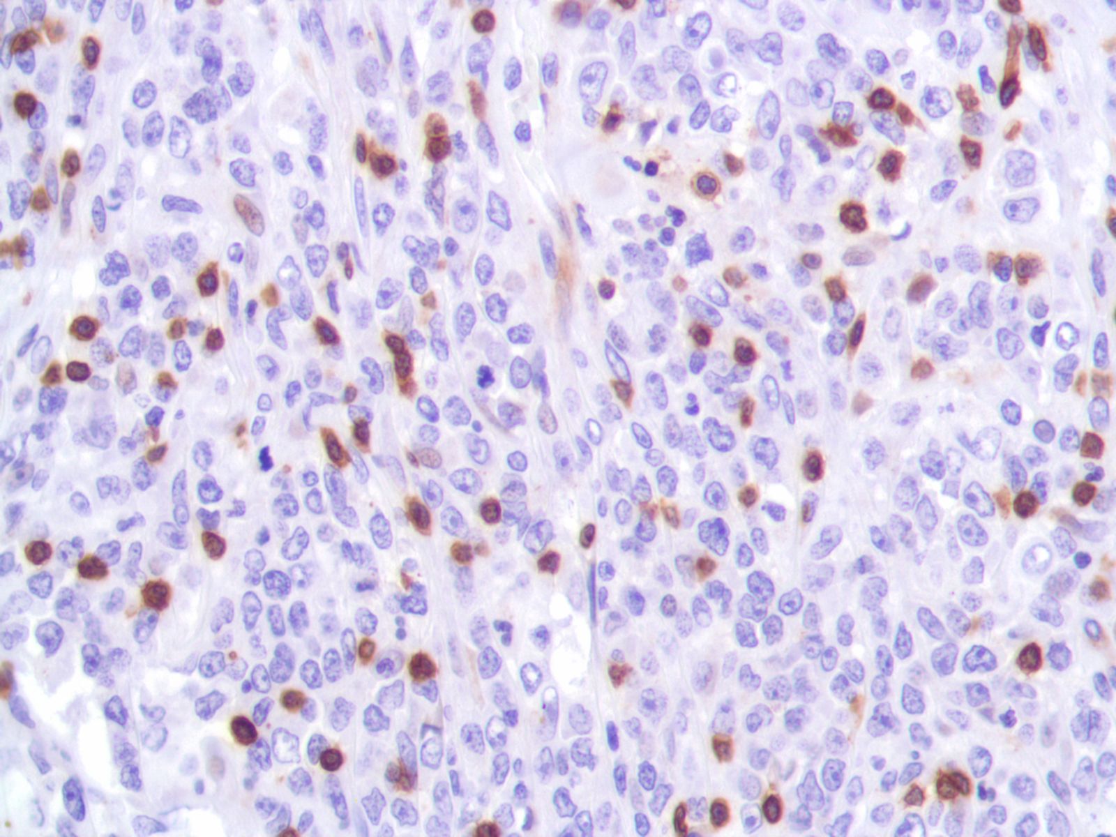 Lymphocyte Marker Antibody Duo (CD3, CD19)(IHCICC) (ARG30127) - arigo ...