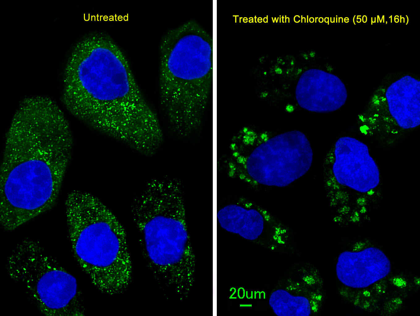 anti-LC3B antibody (ARG54707) - arigo Biolaboratories