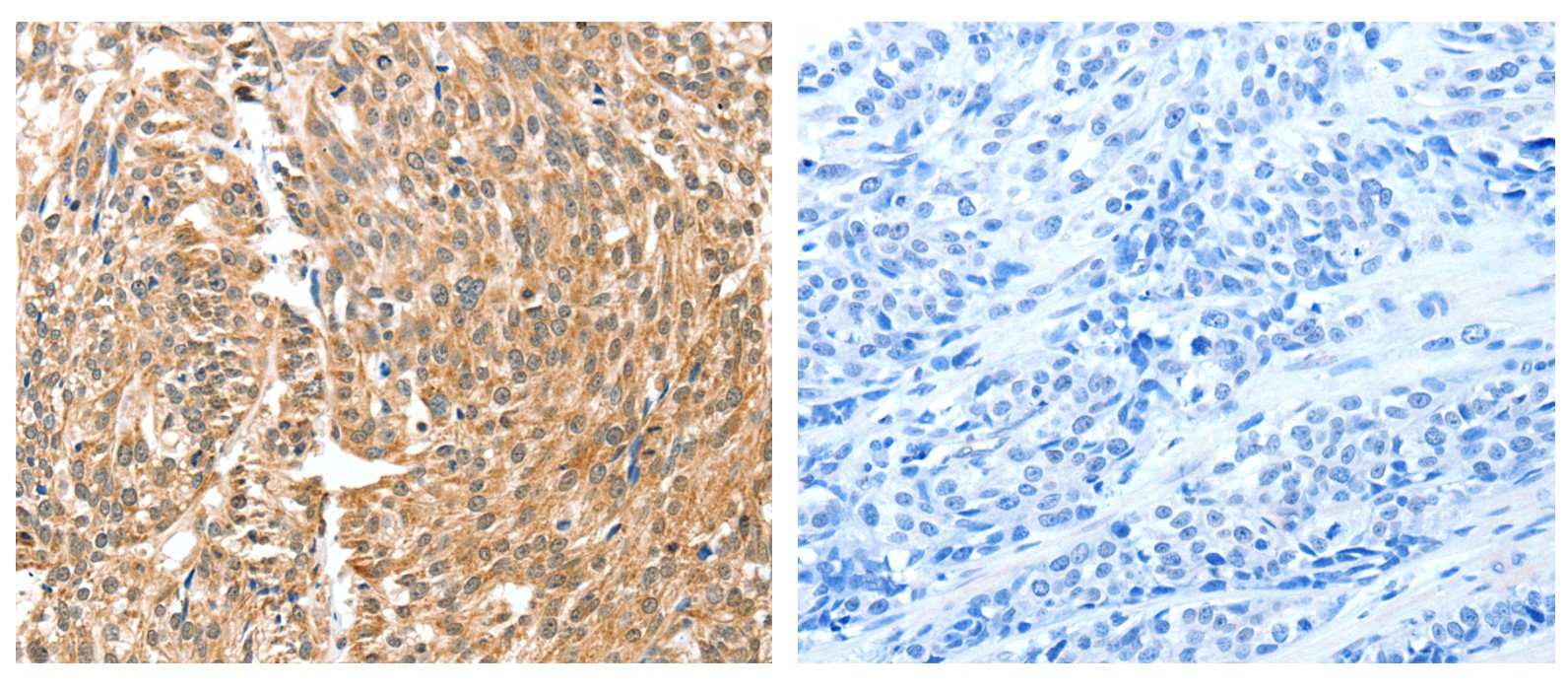 Apoptosis Marker Antibody Duo (Bcl2, Bax) (ARG30268) - arigo ...